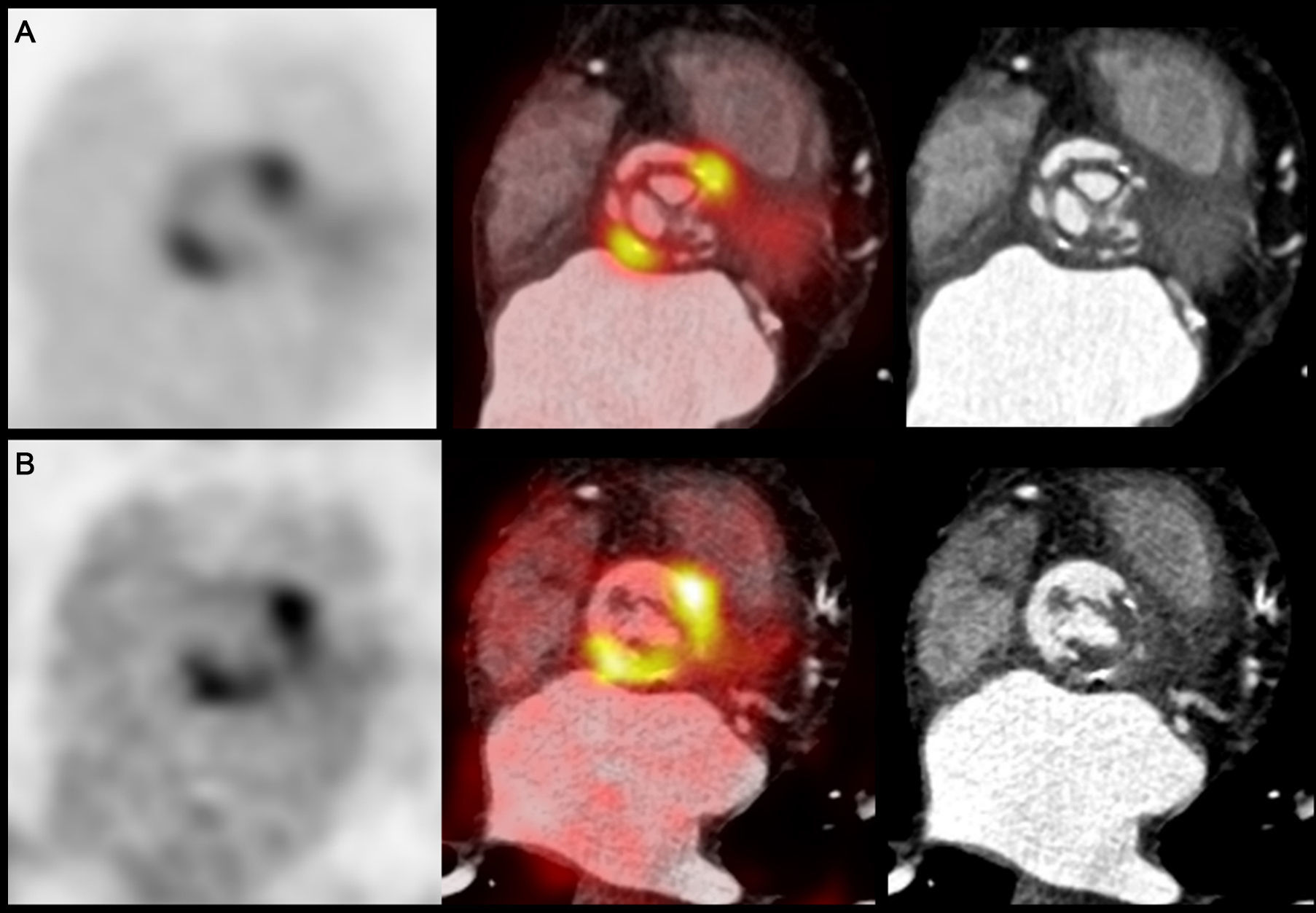 Nuclear Cardiology: Role in the World of Multimodality Cardiac Imaging ...