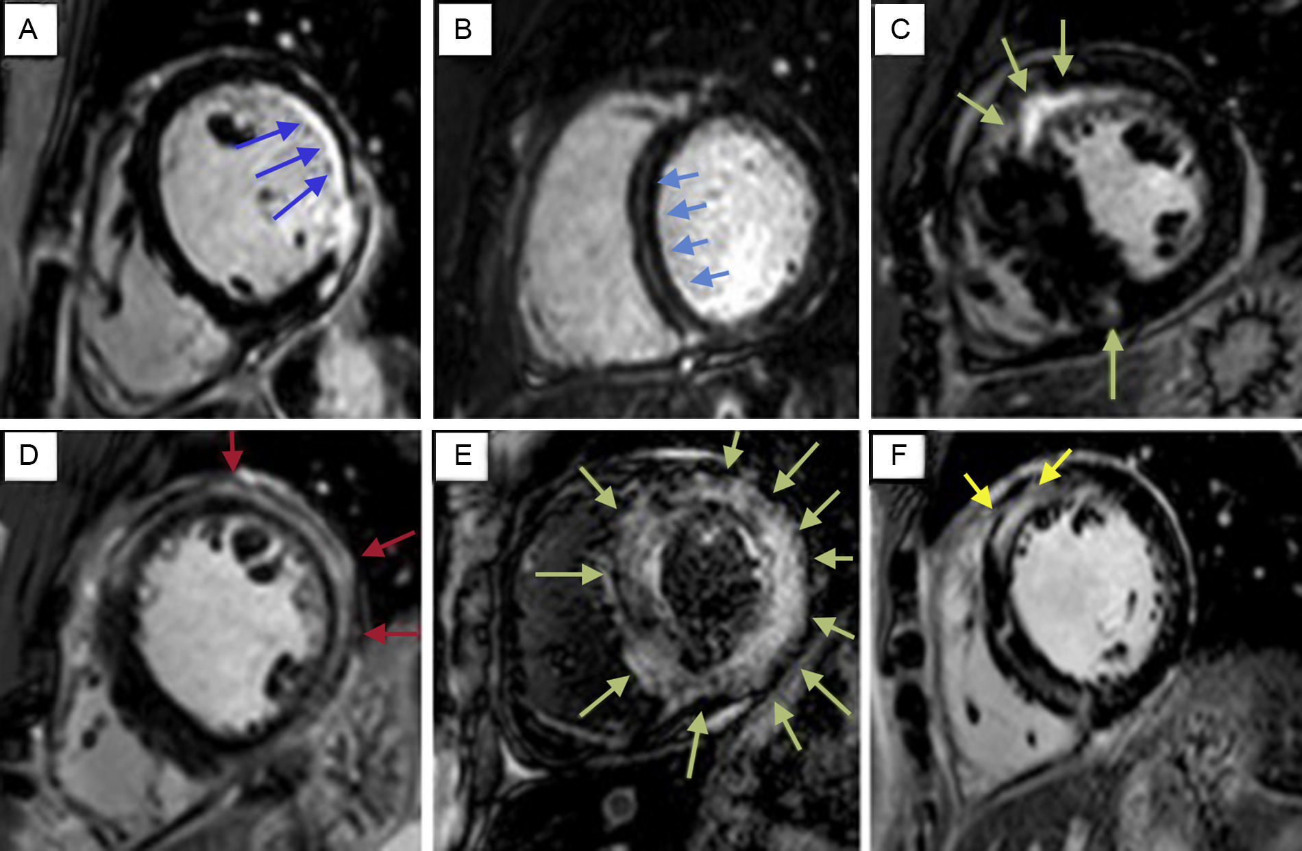 Cardiovascular Magnetic Resonance in Cardiology Practice: A Concise ...