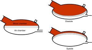 Two Different Sites of Membrane Rupture in the Berlin-Heart EXCOR ...