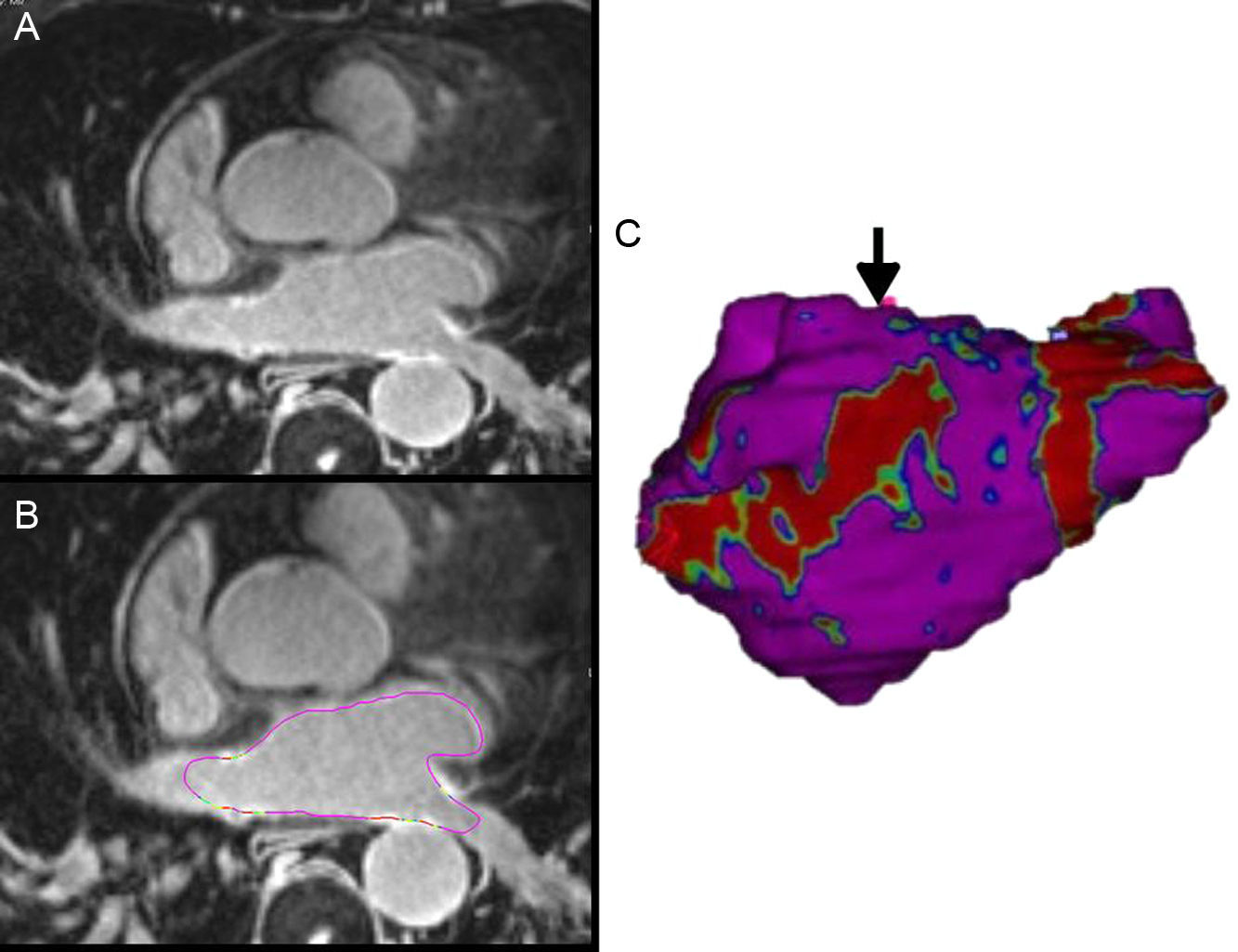 Cardiovascular Imaging in the Electrophysiology Laboratory | Revista ...