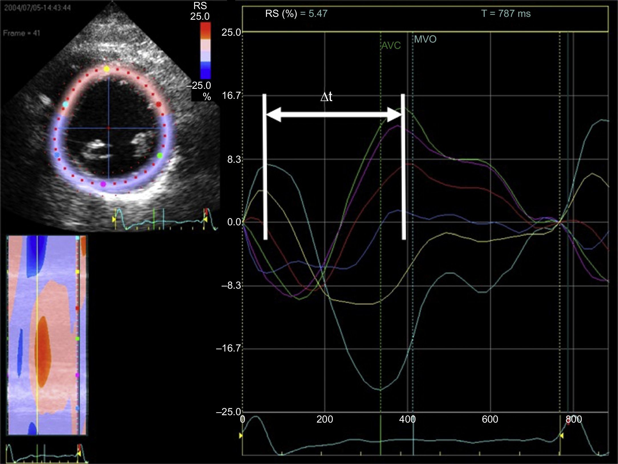 Cardiovascular Imaging in the Electrophysiology Laboratory | Revista ...