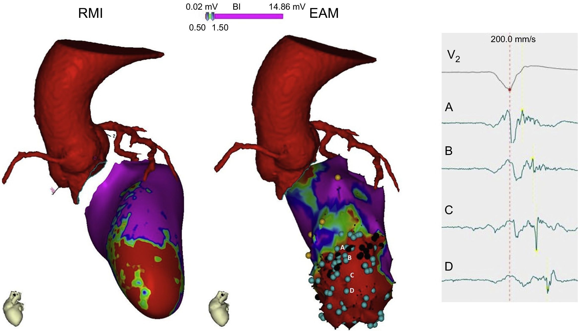 Cardiovascular Imaging in the Electrophysiology Laboratory | Revista ...