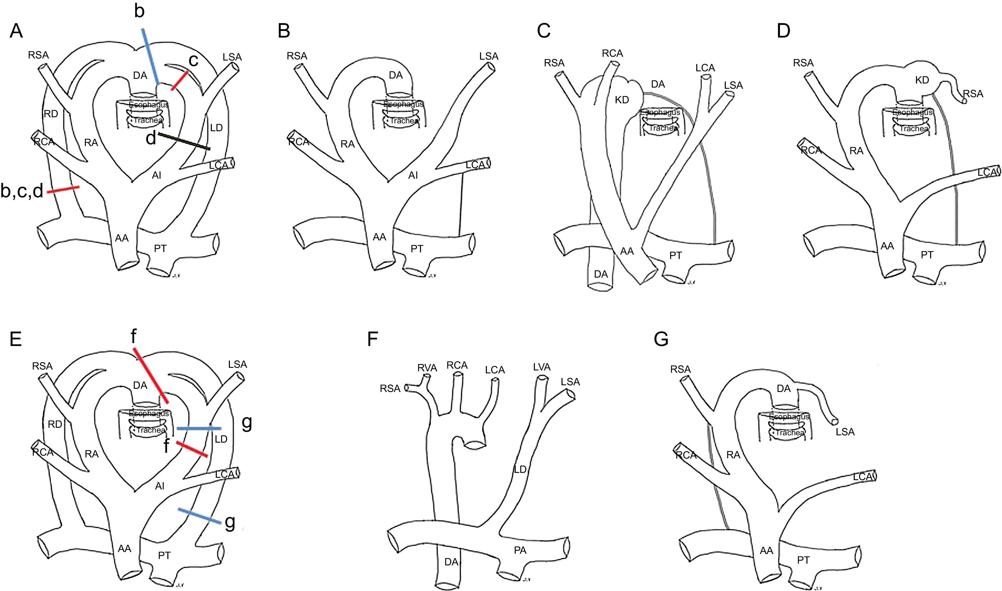 Multidetector Computed Tomography for Congenital Anomalies of the ...