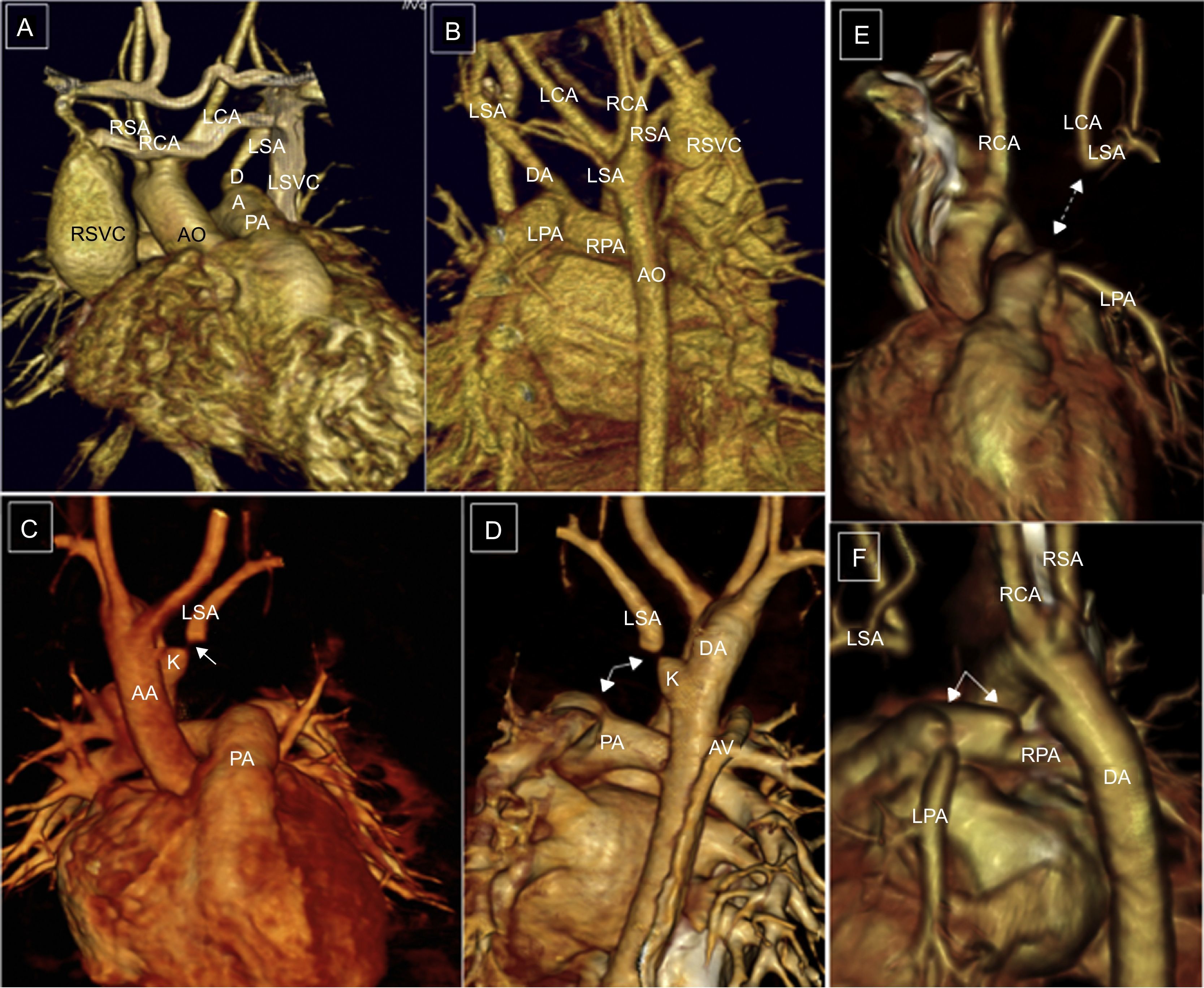Multidetector Computed Tomography for Congenital Anomalies of the ...