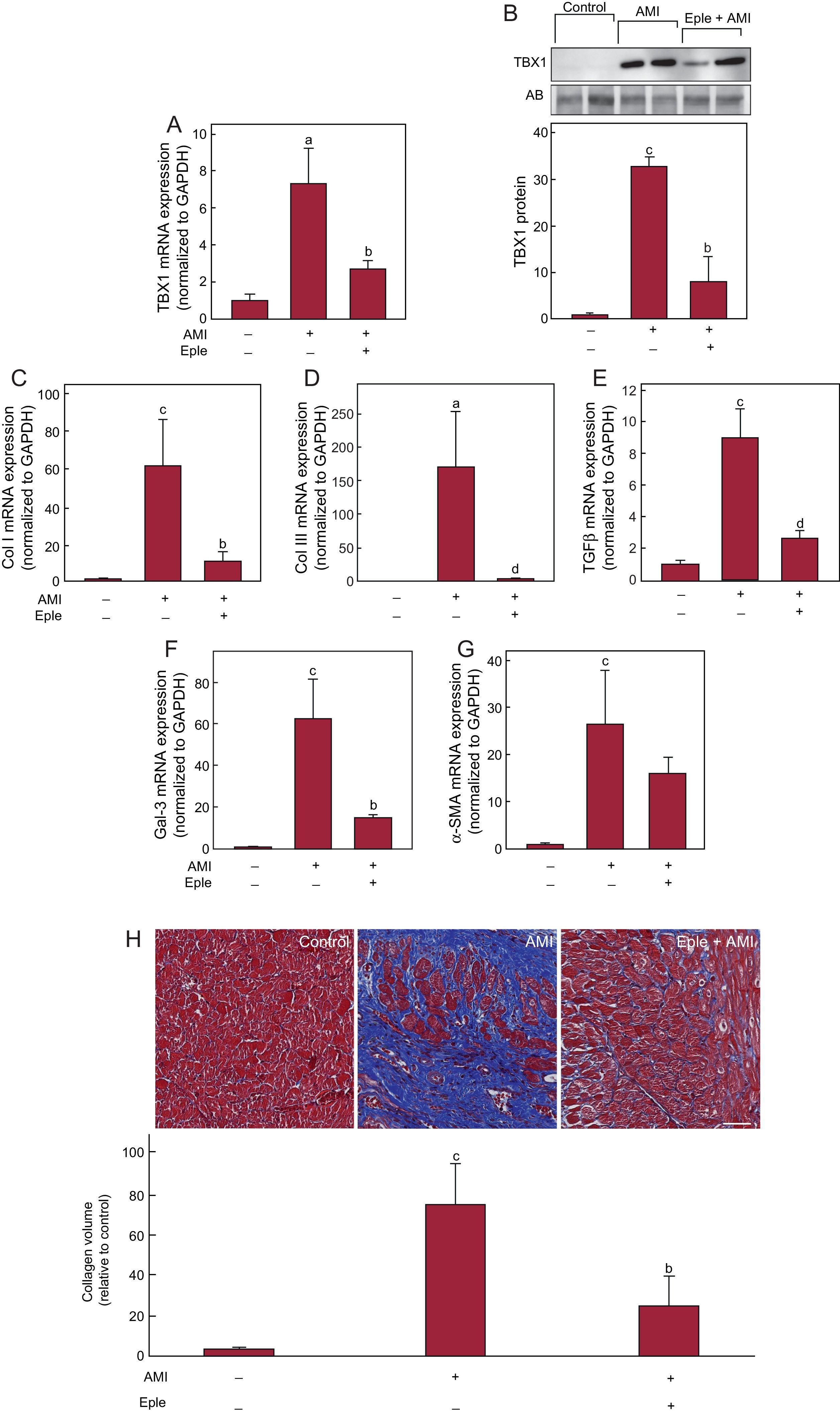 The TBX1 Transcription Factor in Cardiac Remodeling After Myocardial ...