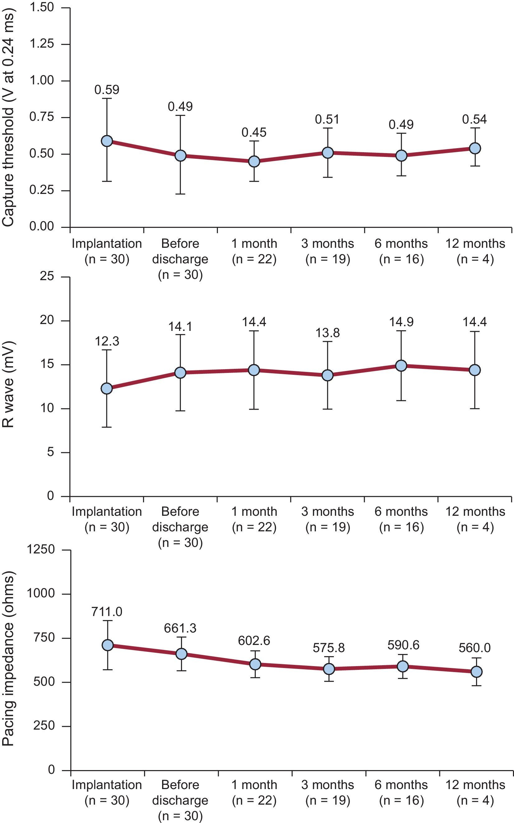 The Micra Leadless Transcatheter Pacemaker. Implantation and Mid-term ...