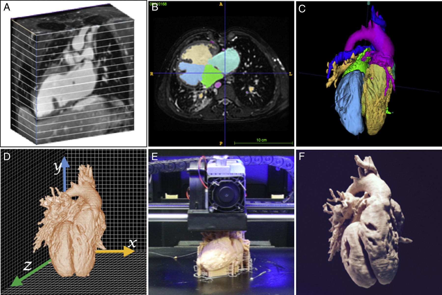Three Dimensional Printed Cardiac Models Applications In The Field Of Medical Education