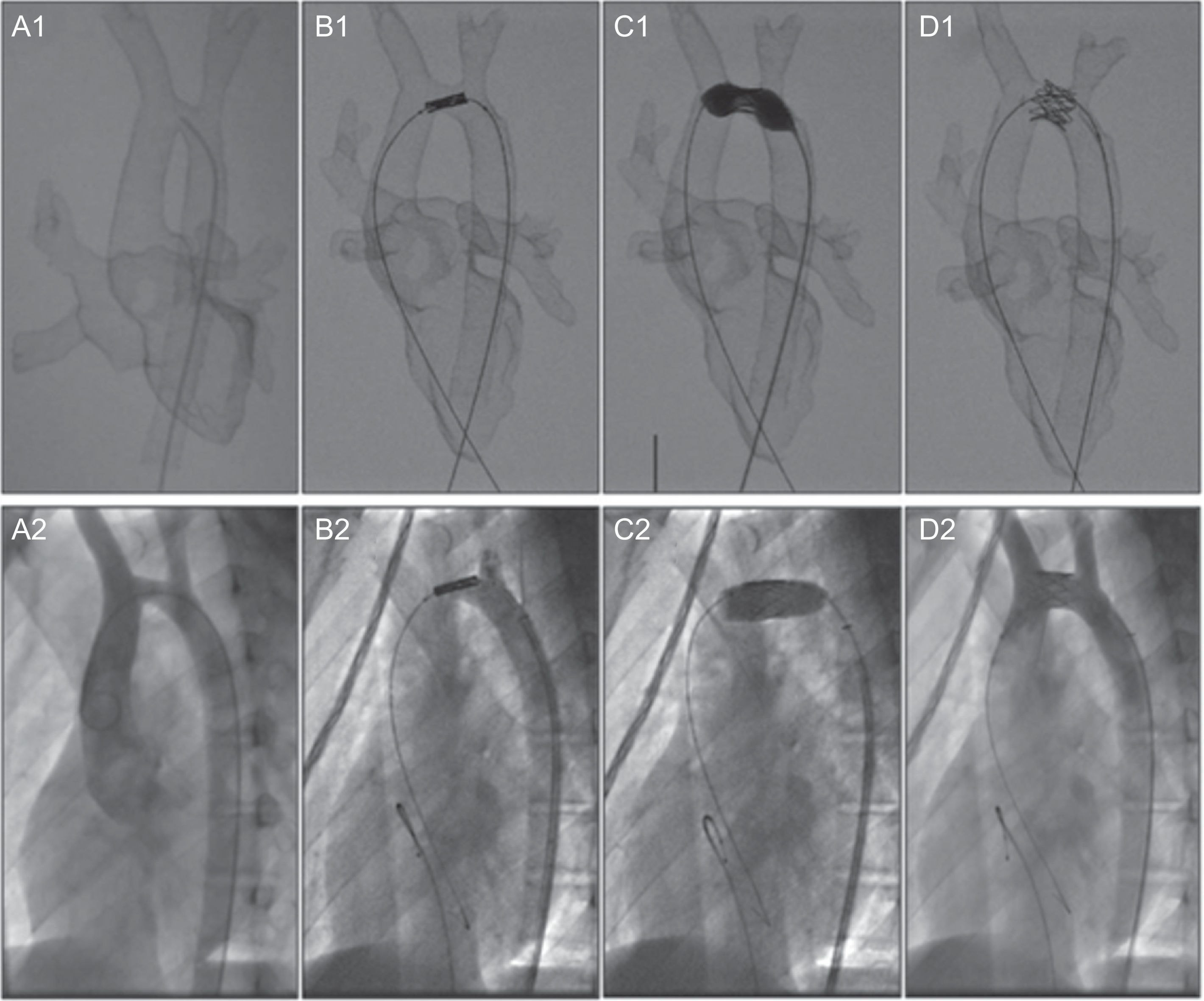 Three-dimensional Printed Cardiac Models: Applications in the Field of ...