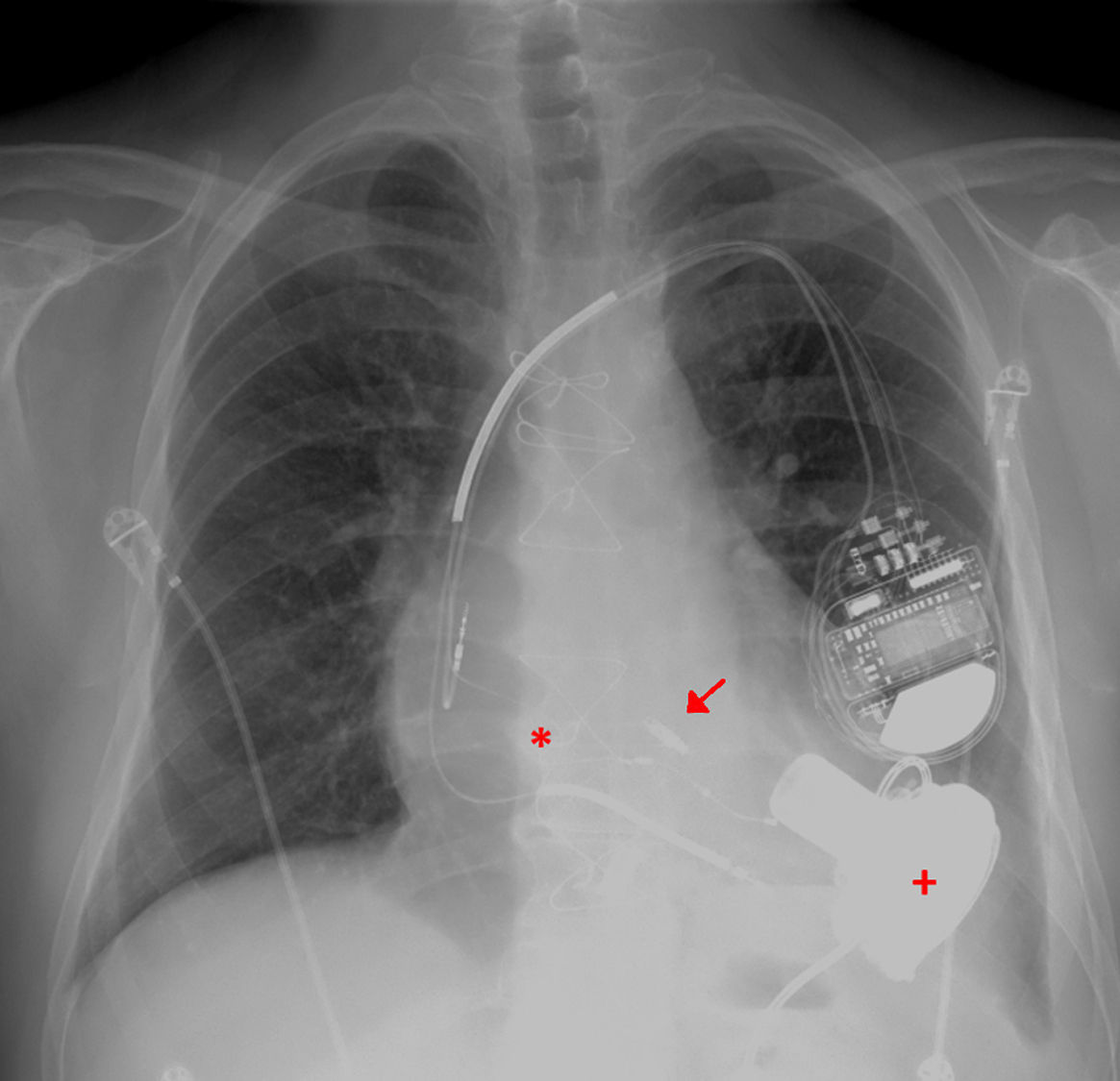 A Three-in-one Snapshot of the Modern Management of Heart Failure ...