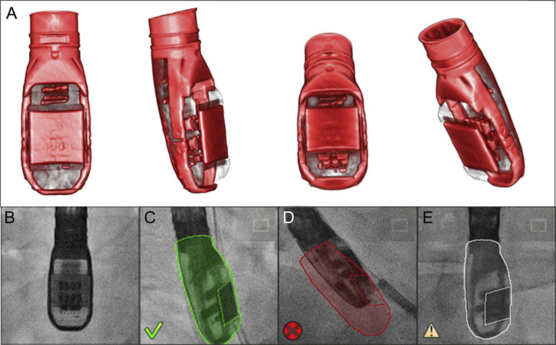 Fusion Imaging for Procedural Guidance | Revista Española de Cardiología