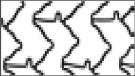 A Brief History of Coronary Artery Stents | Revista Española de Cardiología