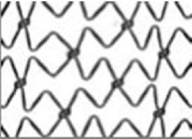 A Brief History of Coronary Artery Stents | Revista Española de Cardiología