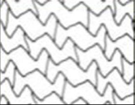 A Brief History of Coronary Artery Stents | Revista Española de Cardiología