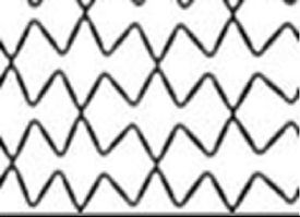 A Brief History of Coronary Artery Stents | Revista Española de Cardiología