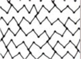 A Brief History of Coronary Artery Stents | Revista Española de Cardiología