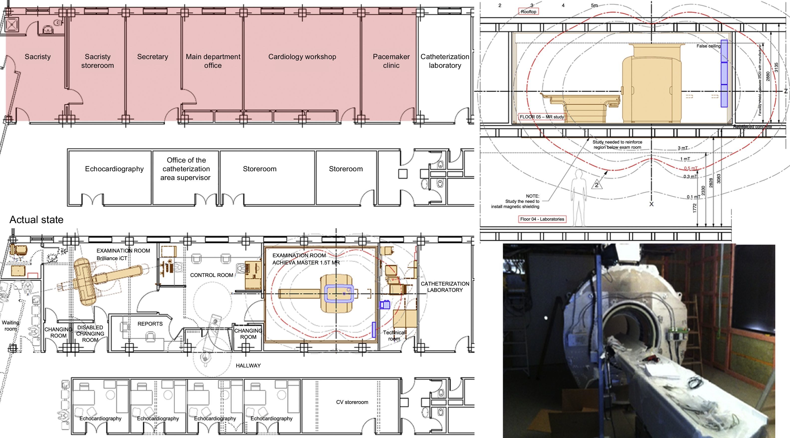 First Magnetic Resonance Managed by a Cardiology Department in the ...