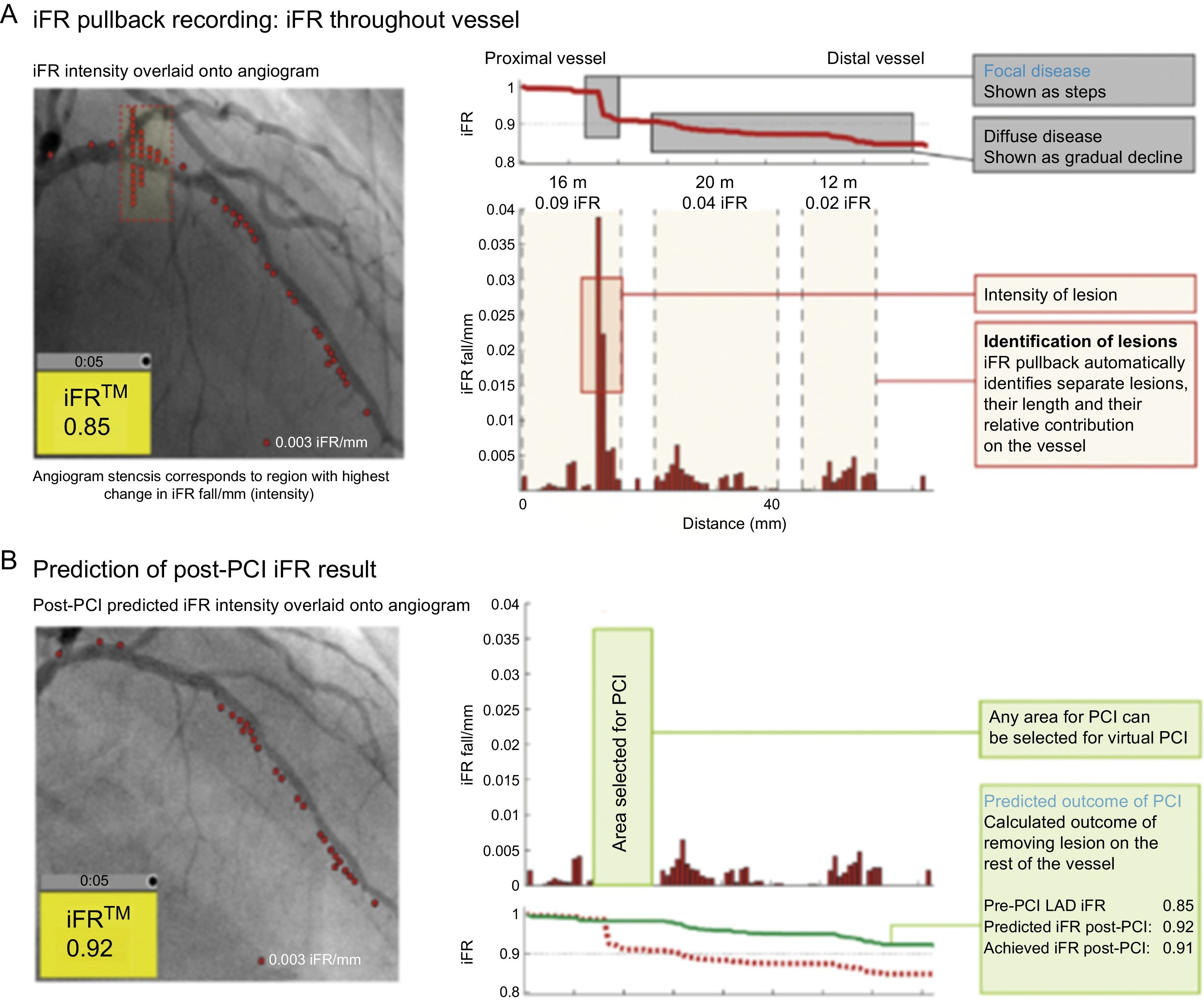 Past, Present and Future of Coronary Physiology - Revista Española de ...