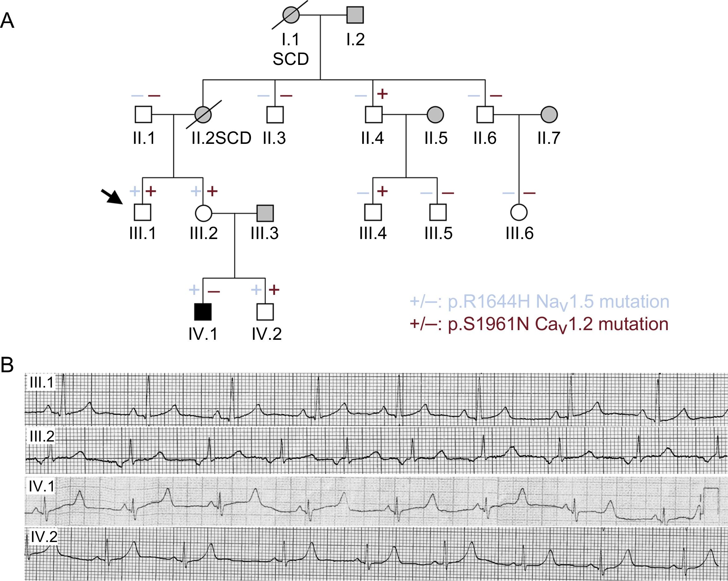 Digenic Heterozigosity in SCN5A and CACNA1C Explains the Variable ...