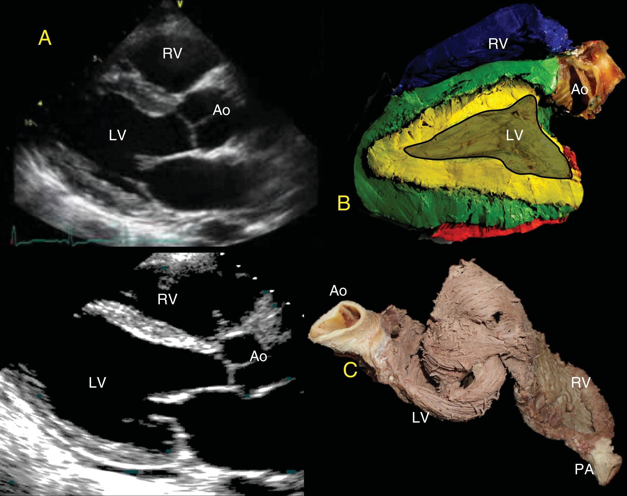 Anatomical Correlation of the Helical Structure of the Ventricular ...
