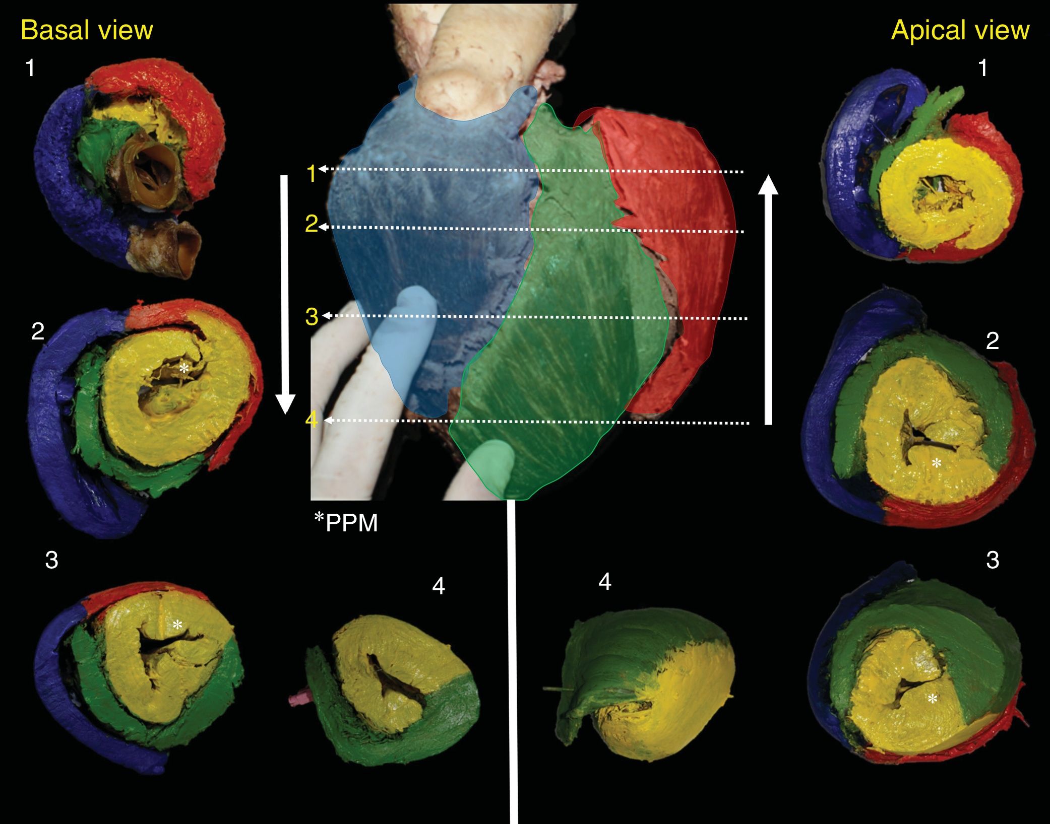 Anatomical Correlation of the Helical Structure of the Ventricular ...