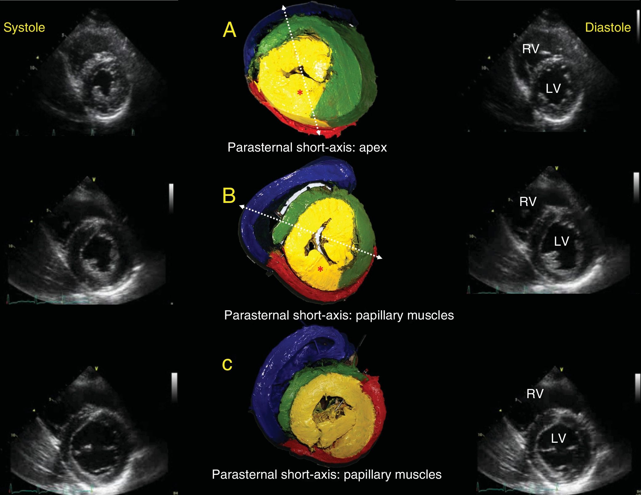 Anatomical Correlation of the Helical Structure of the Ventricular ...