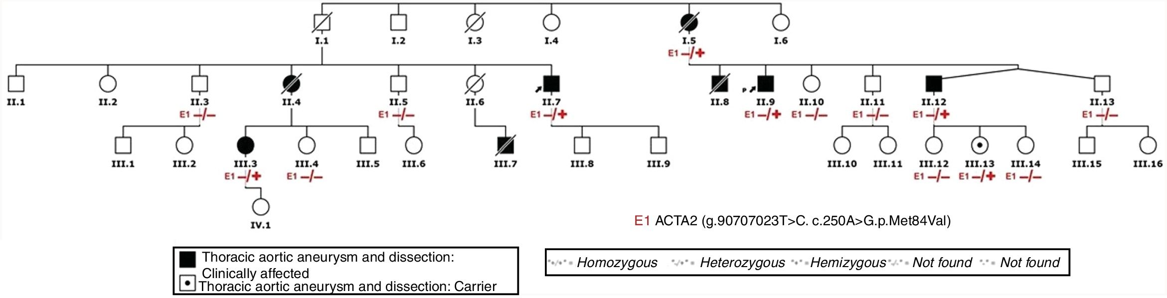 New mutation in the ACTA2 gene (p.Met84Val) in a family with ...