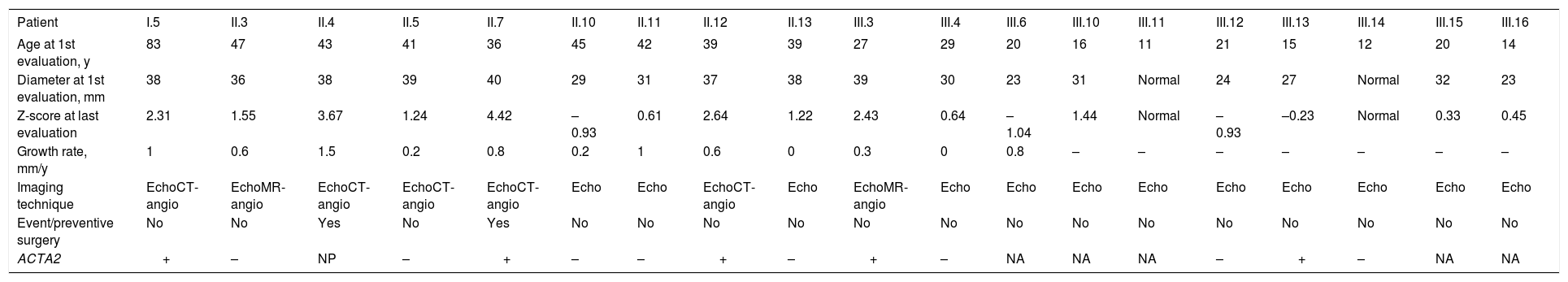 New mutation in the ACTA2 gene (p.Met84Val) in a family with ...