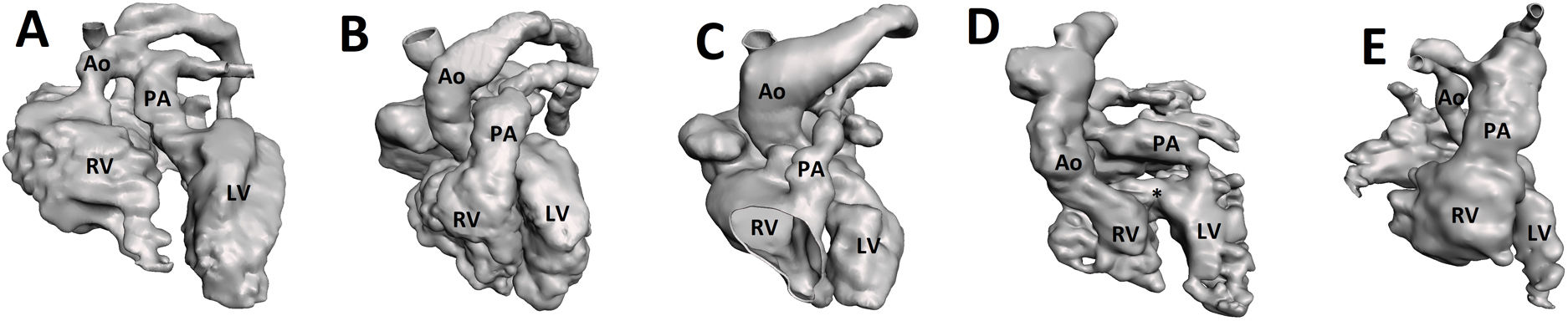 3D ultrasound-based fetal heart reconstruction: a pilot protocol in ...
