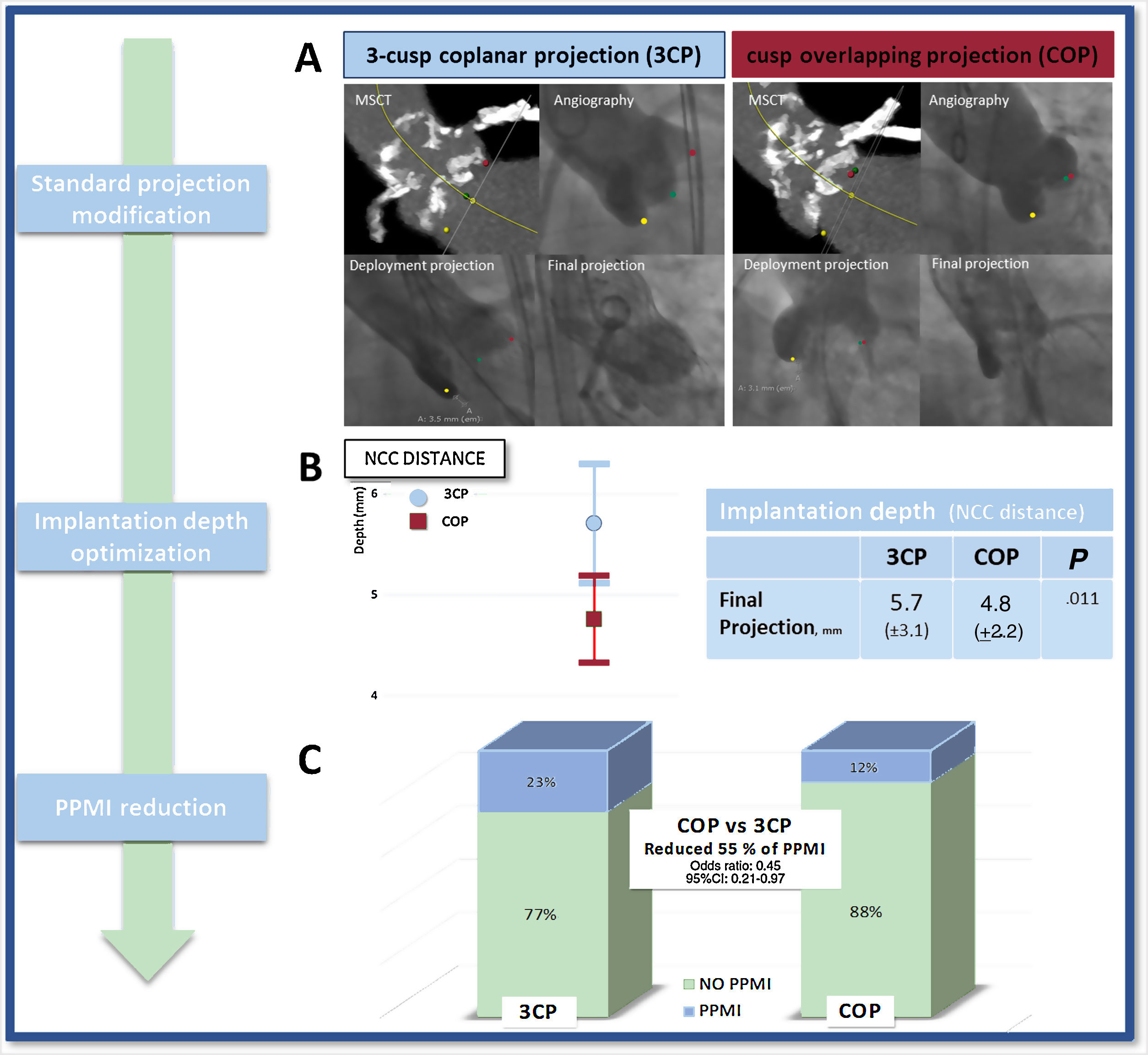 Cusp-overlapping TAVI technique with a self-expanding device optimizes ...