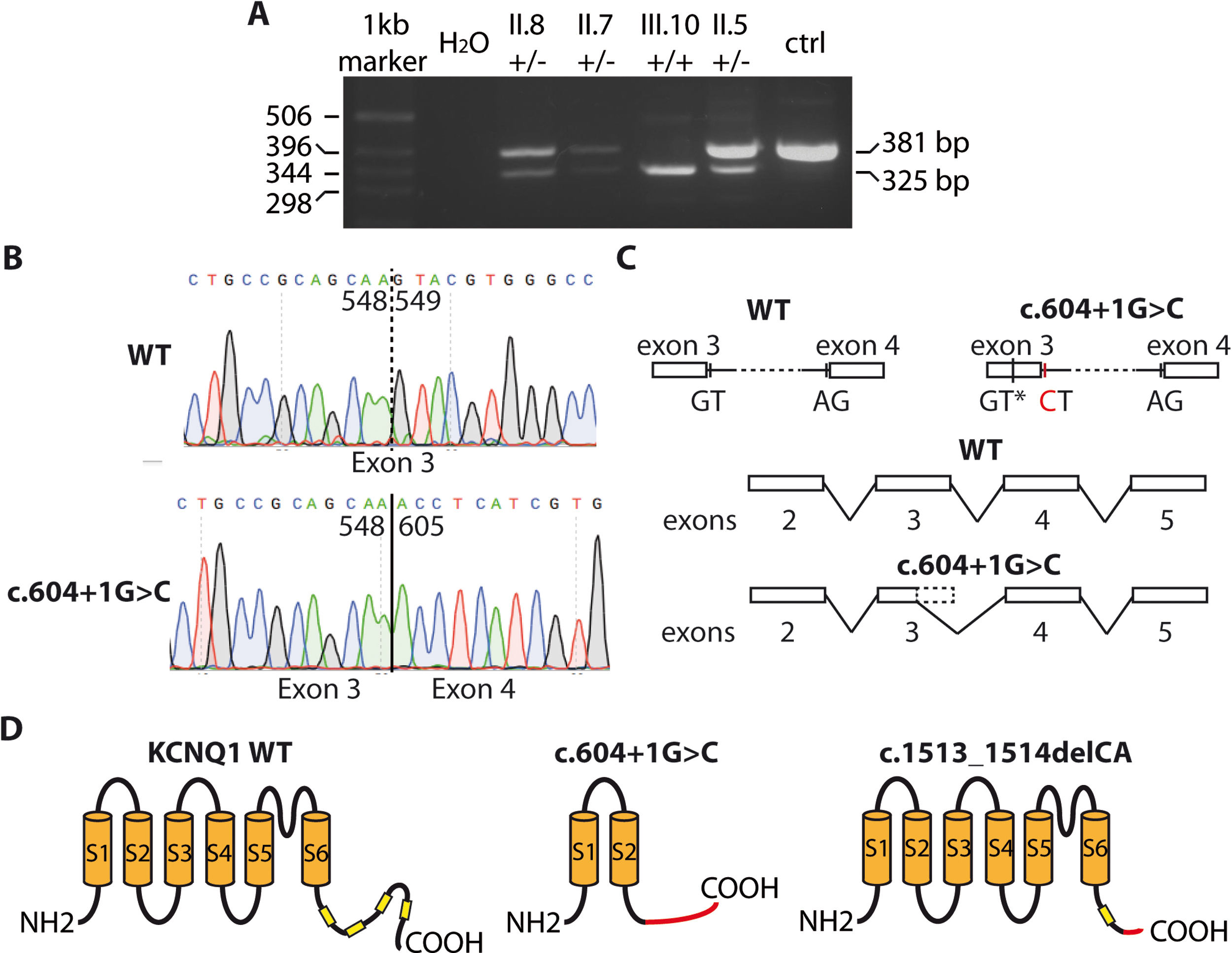 New KCNQ1 c.604+1G>C variant associated with Jervell-Lange Nielsen ...