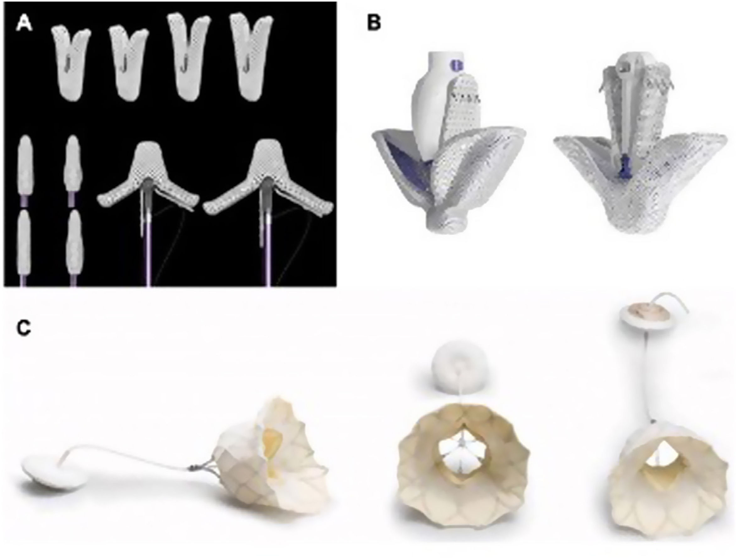 Mitral and tricuspid valve disease: diagnosis and management. Consensus ...