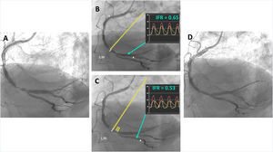 Medina classification since its description in 2005 | Revista Española ...