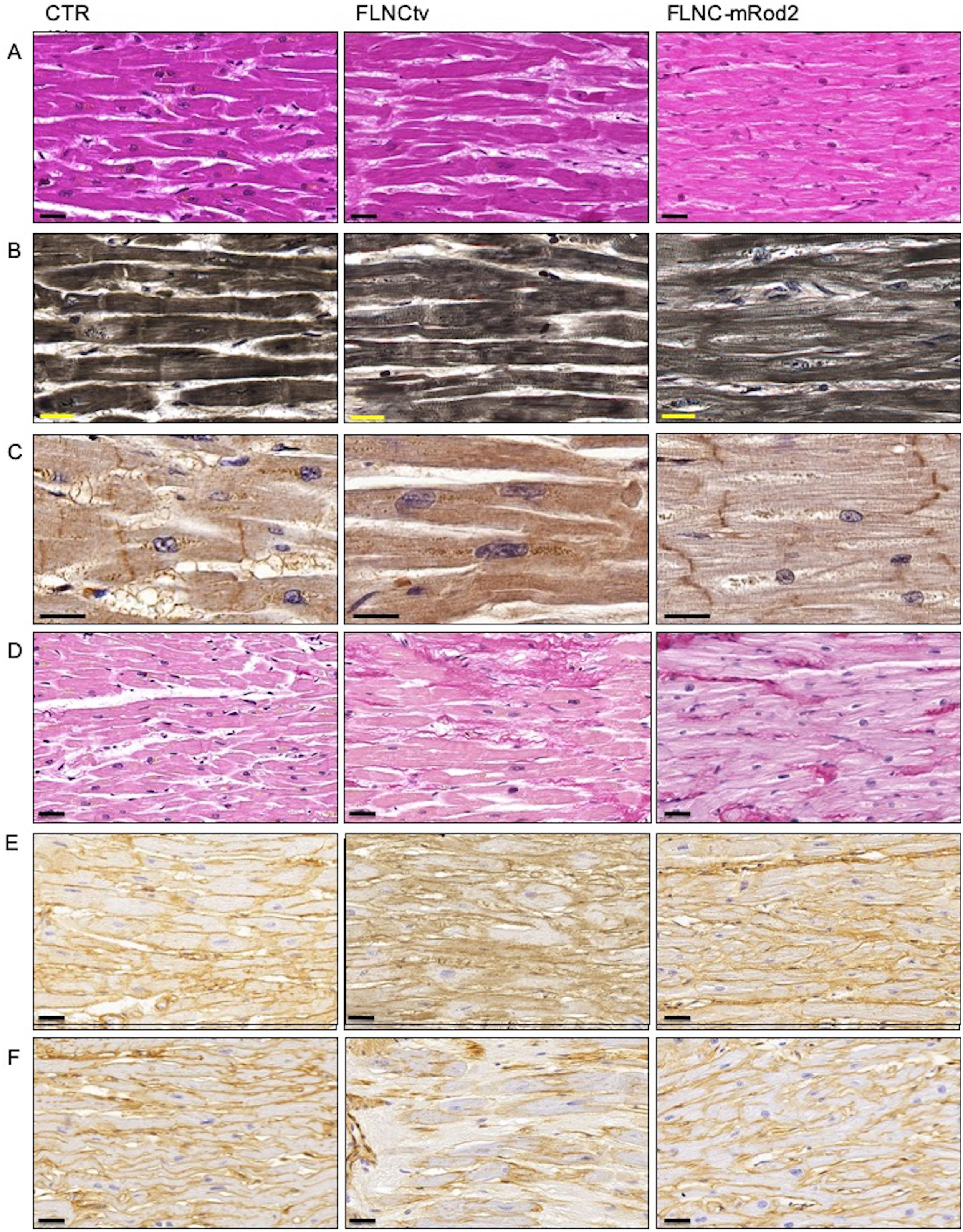 ROD2 domain filamin C missense mutations exhibit a distinctive cardiac ...