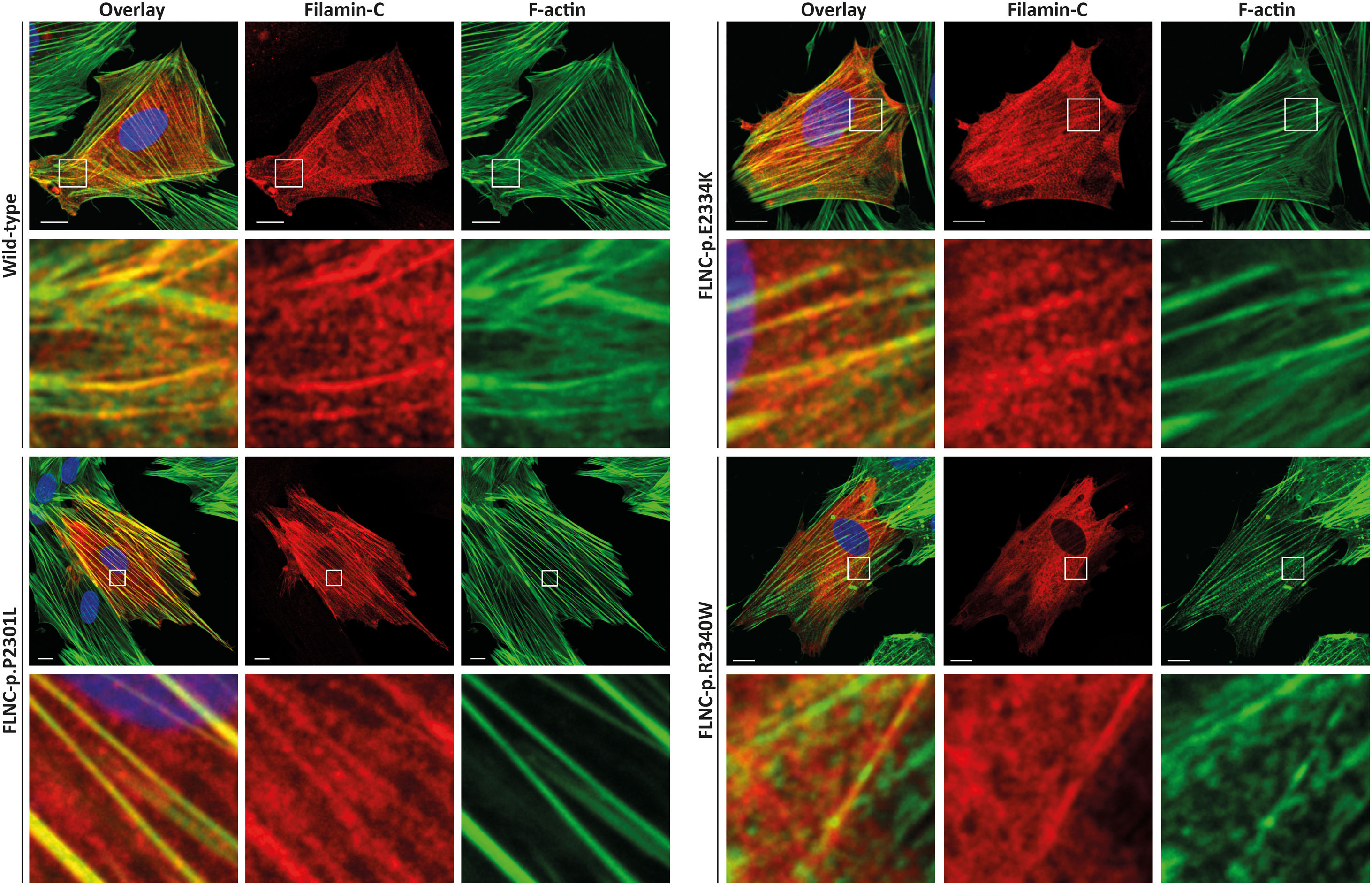 ROD2 domain filamin C missense mutations exhibit a distinctive cardiac ...