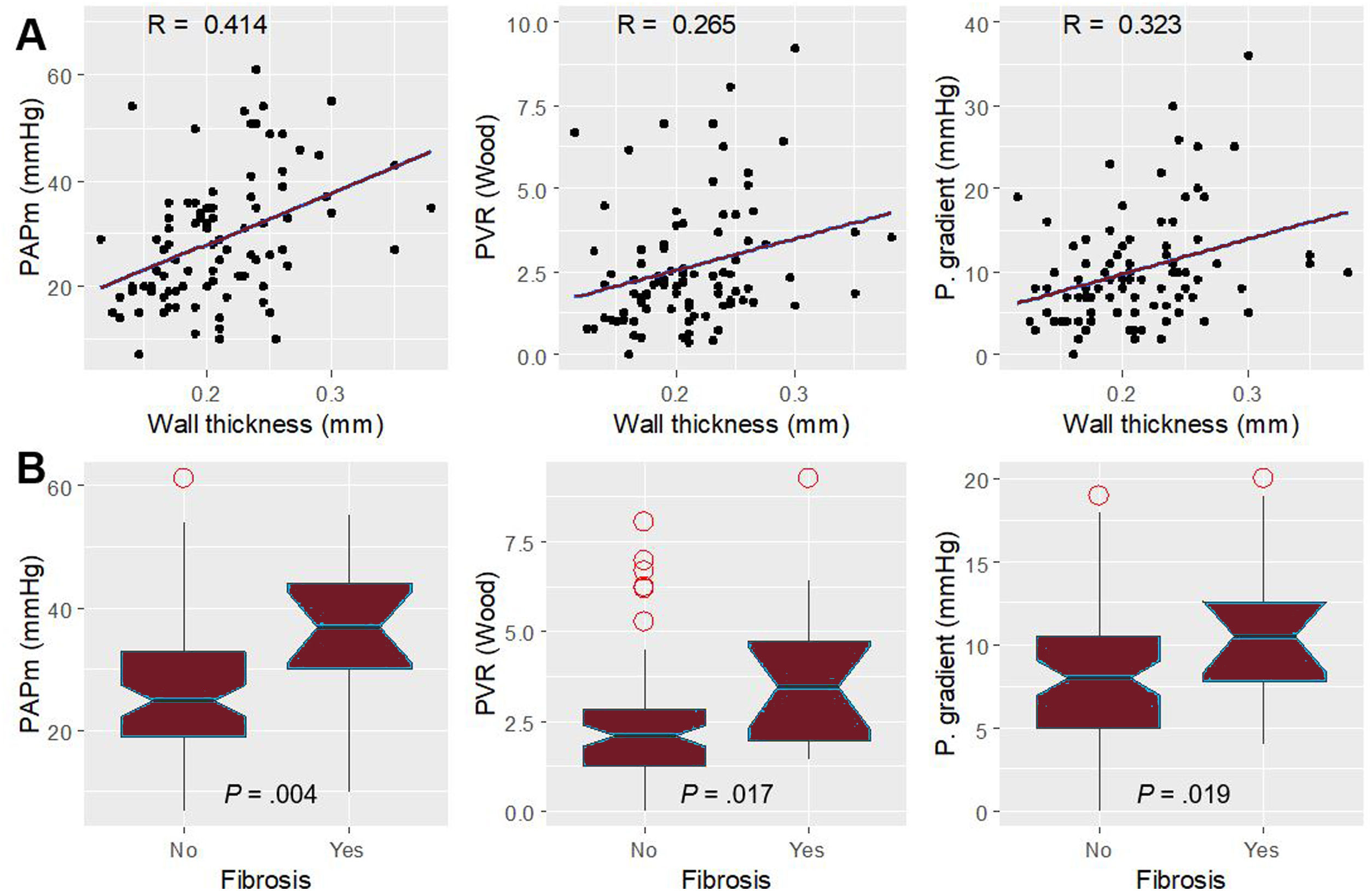 Optical coherence tomography assessment of pulmonary vascular ...