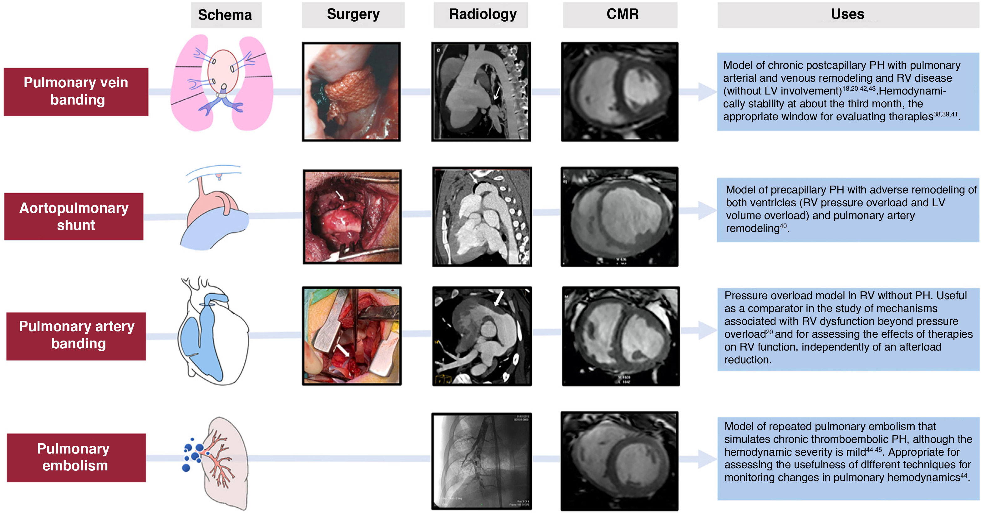 Right ventricular dysfunction: pathophysiology, experimental models ...
