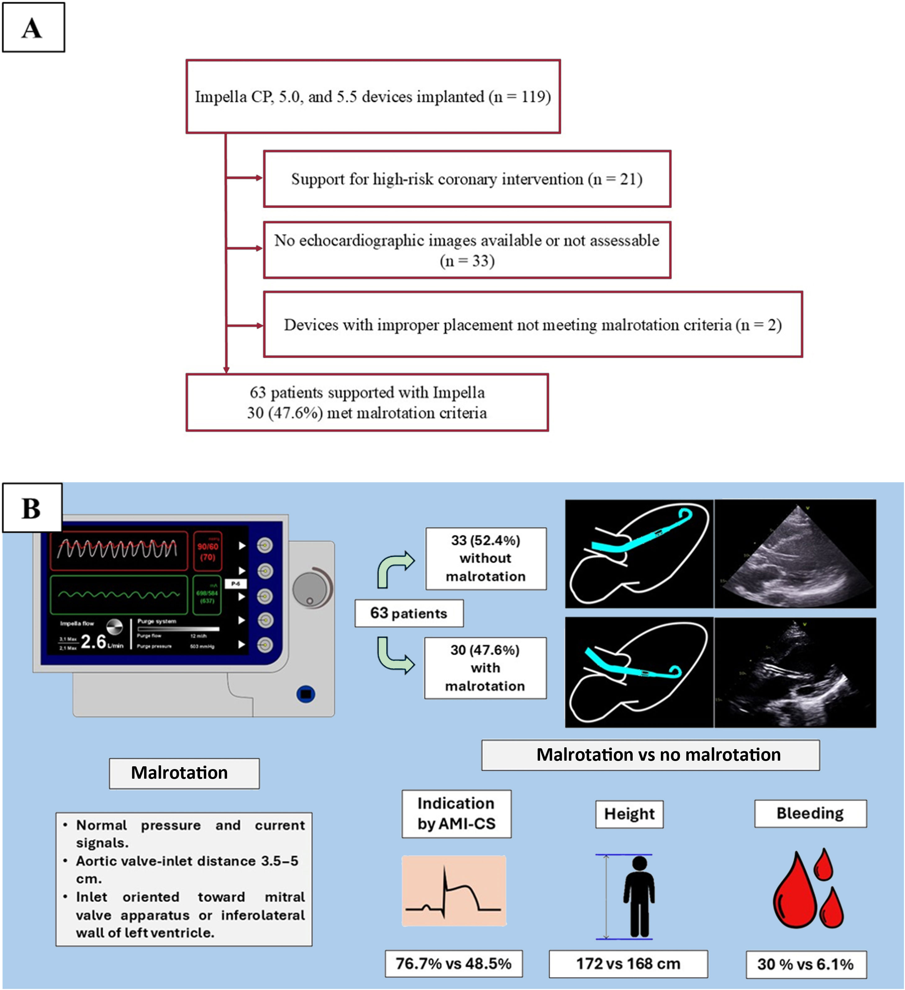 Microaxial flow pump malrotation and cardiogenic shock outcomes ...