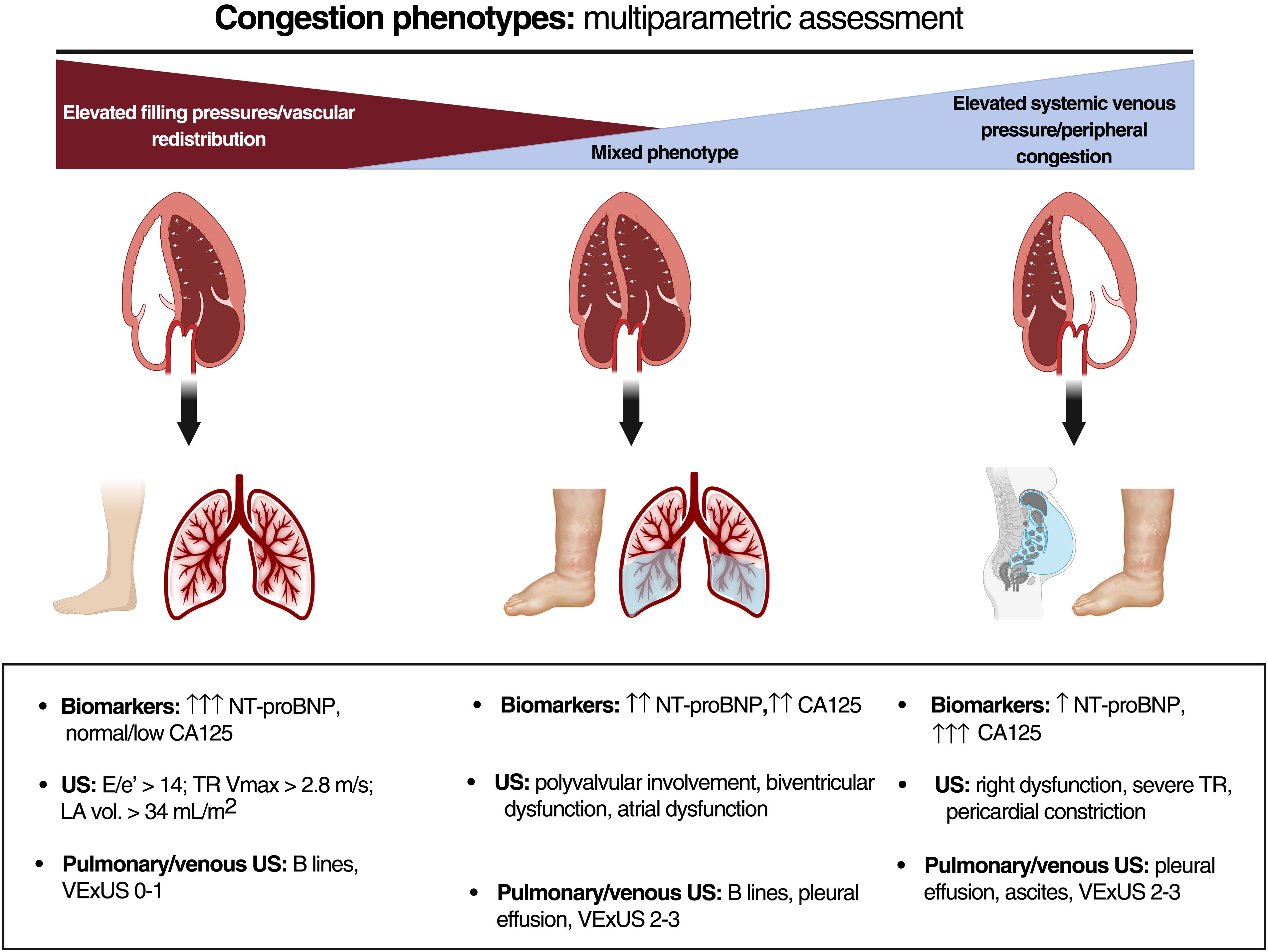 Consensus on the approach to hydrosaline overload in acute heart ...