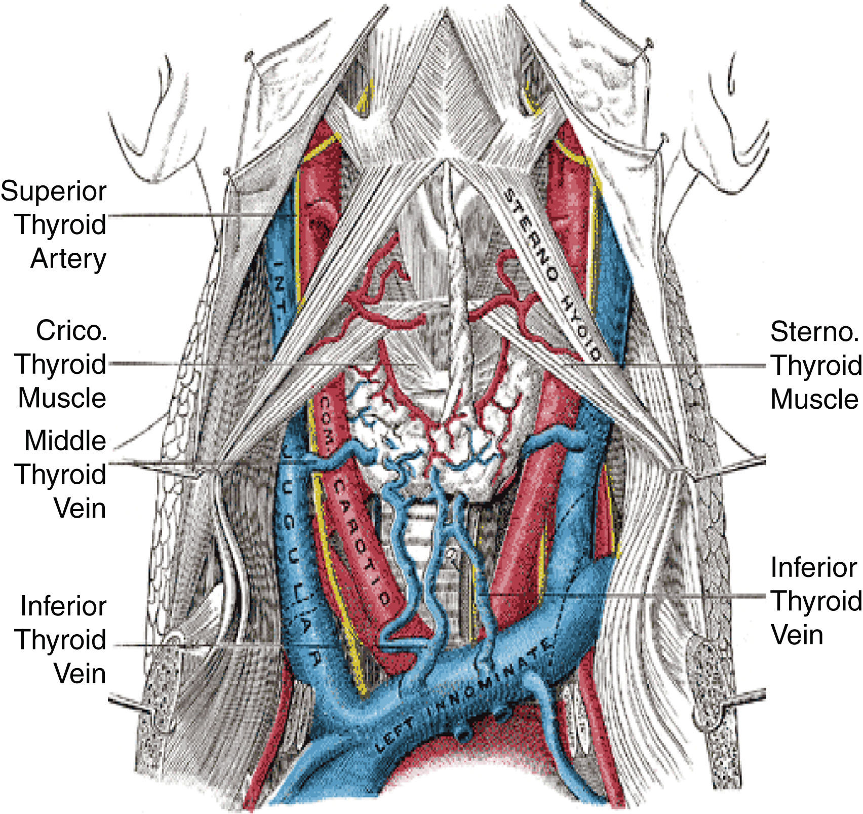 The jugular approach | Diálisis y Trasplante