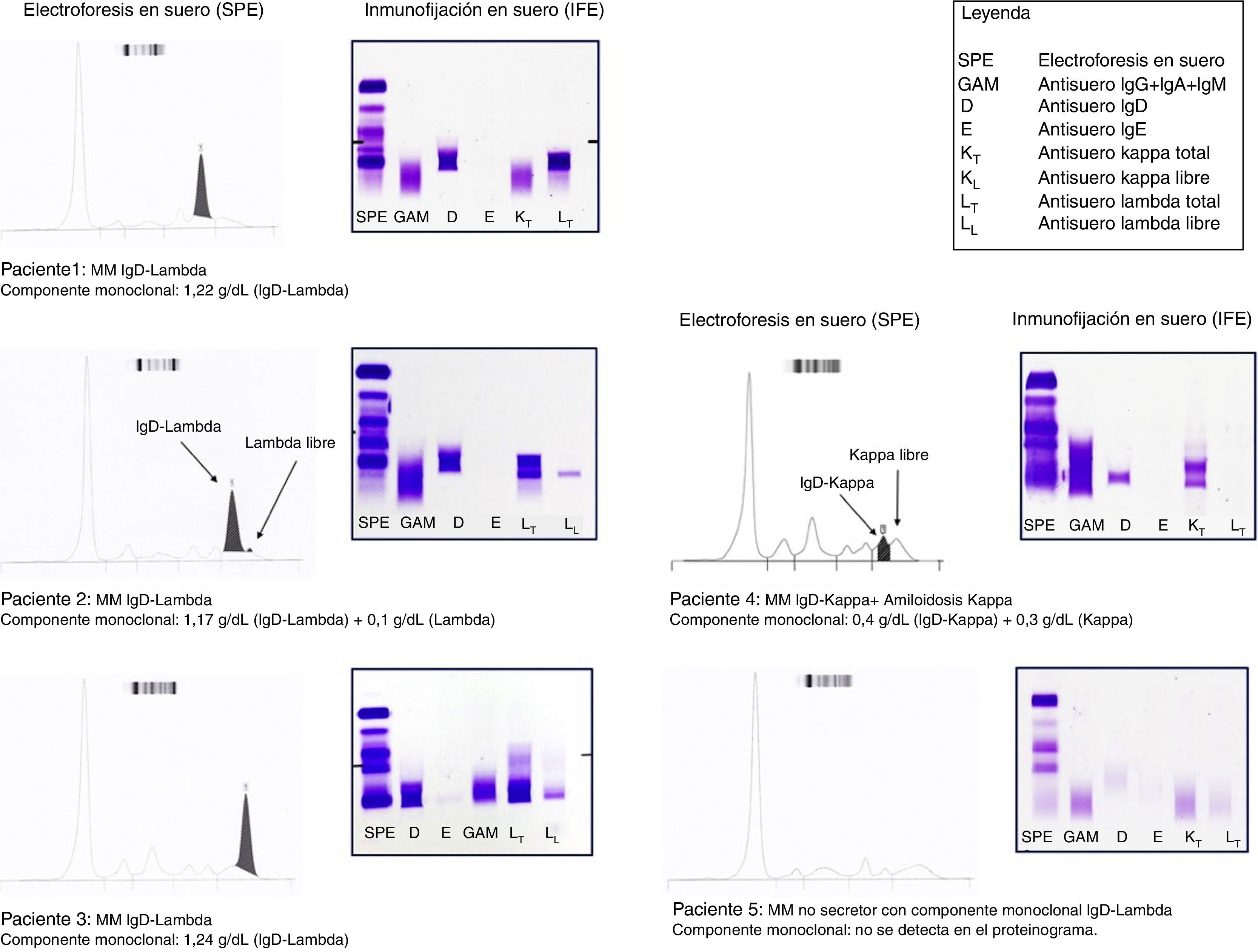 panel de mieloma multiple