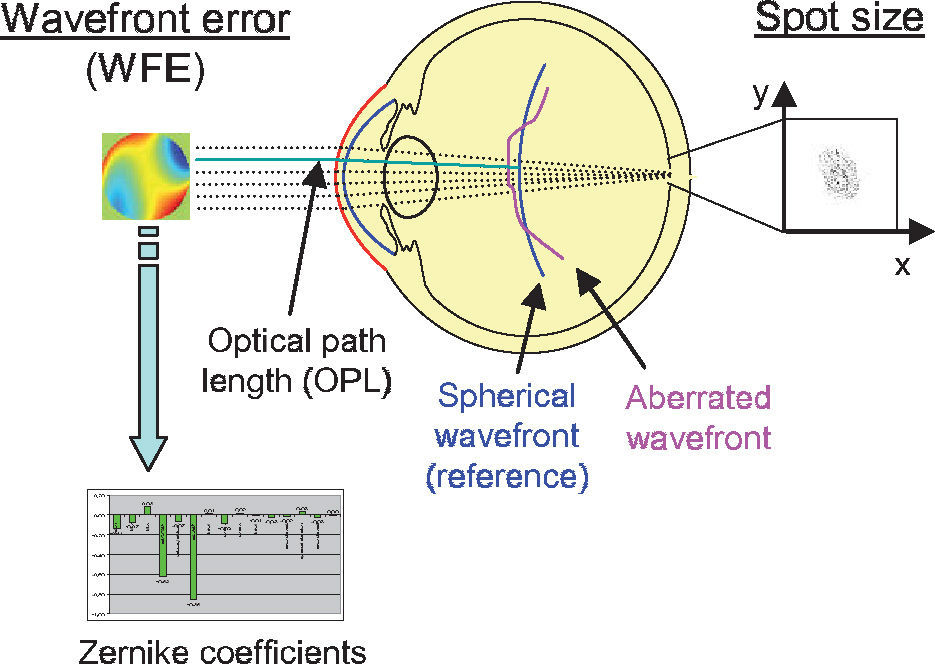 The Individual Virtual Eye: a Computer Model for Advanced Intraocular ...