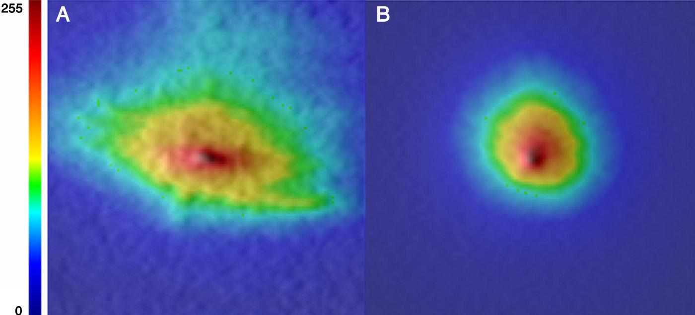 Interocular differences in visual quality due to ocular aberrations and ...