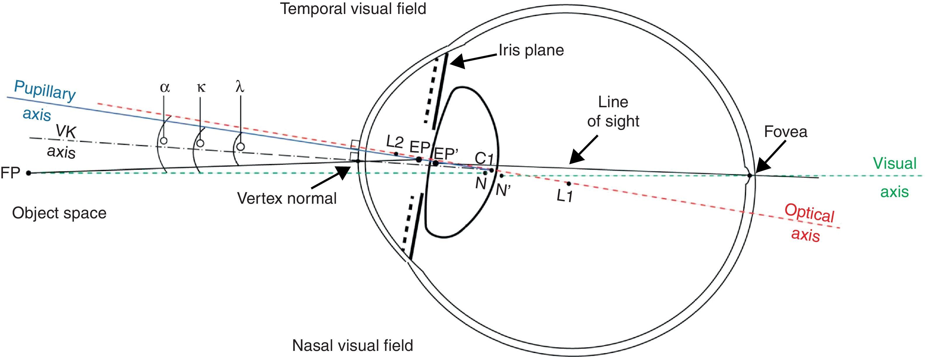 Bilateral symmetry in vision and influence of ocular surgical ...
