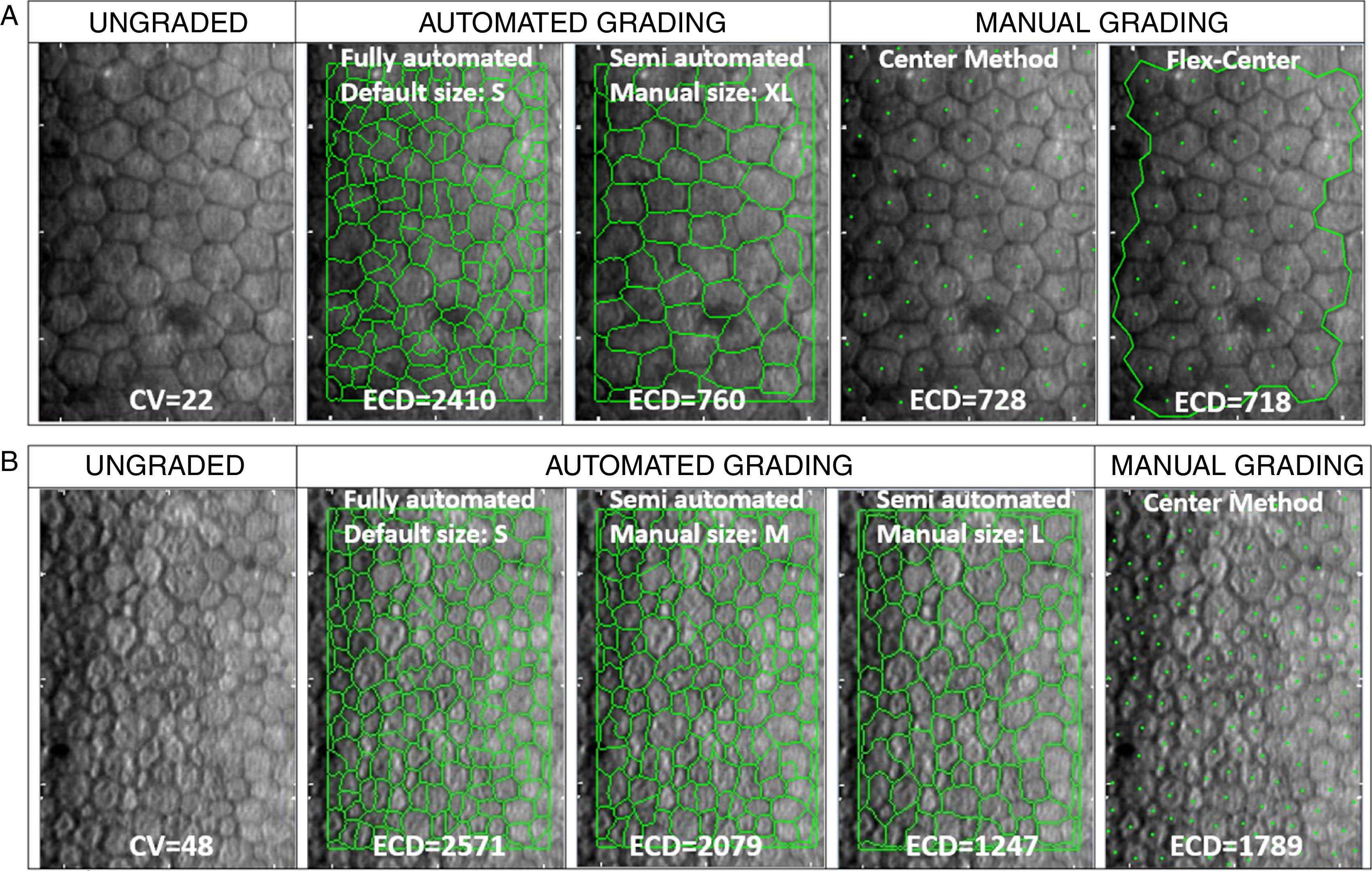 Comparison of manual & automated analysis methods for corneal ...