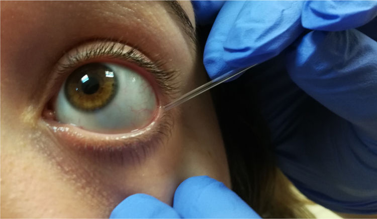 Efficacy and safety study of an eyelid gel after repeated nocturnal ...