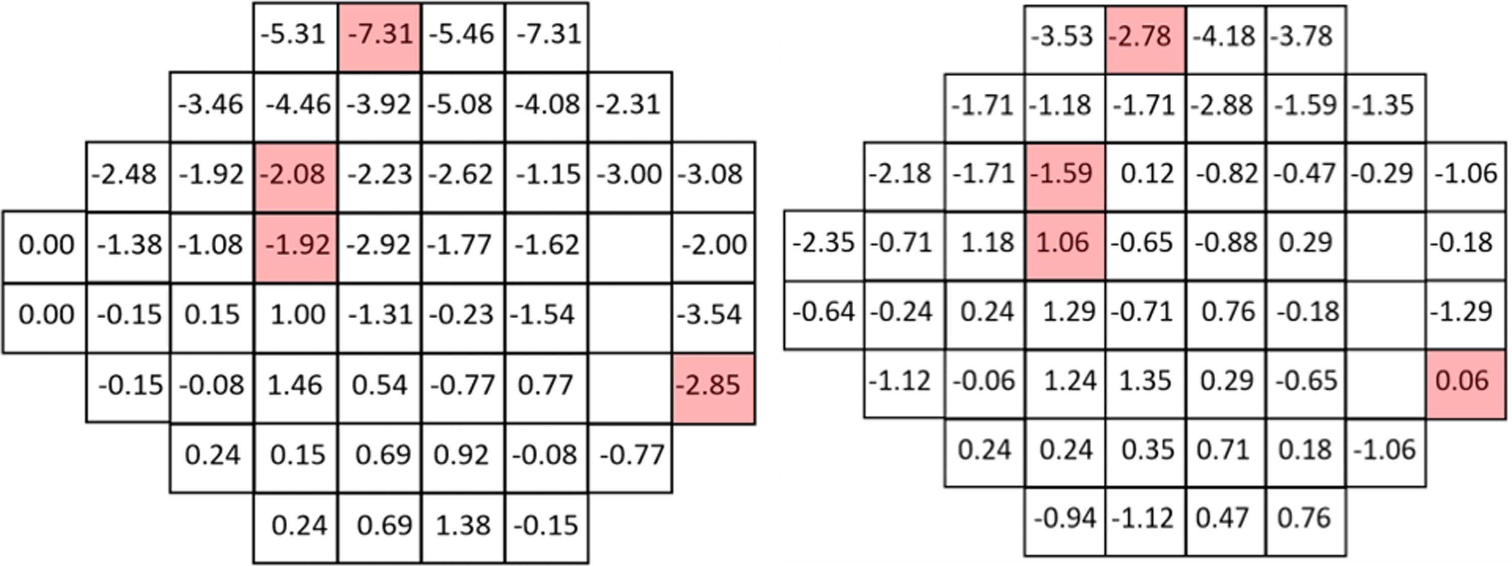 Blue-yellow deficiencies in young moderate smokers | Journal of Optometry