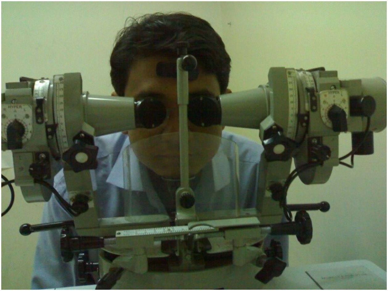 Efficacy of anti-suppression therapy in improving binocular vision in ...