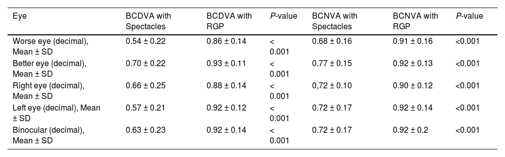 Binocular vision parameters and visual performance in bilateral ...