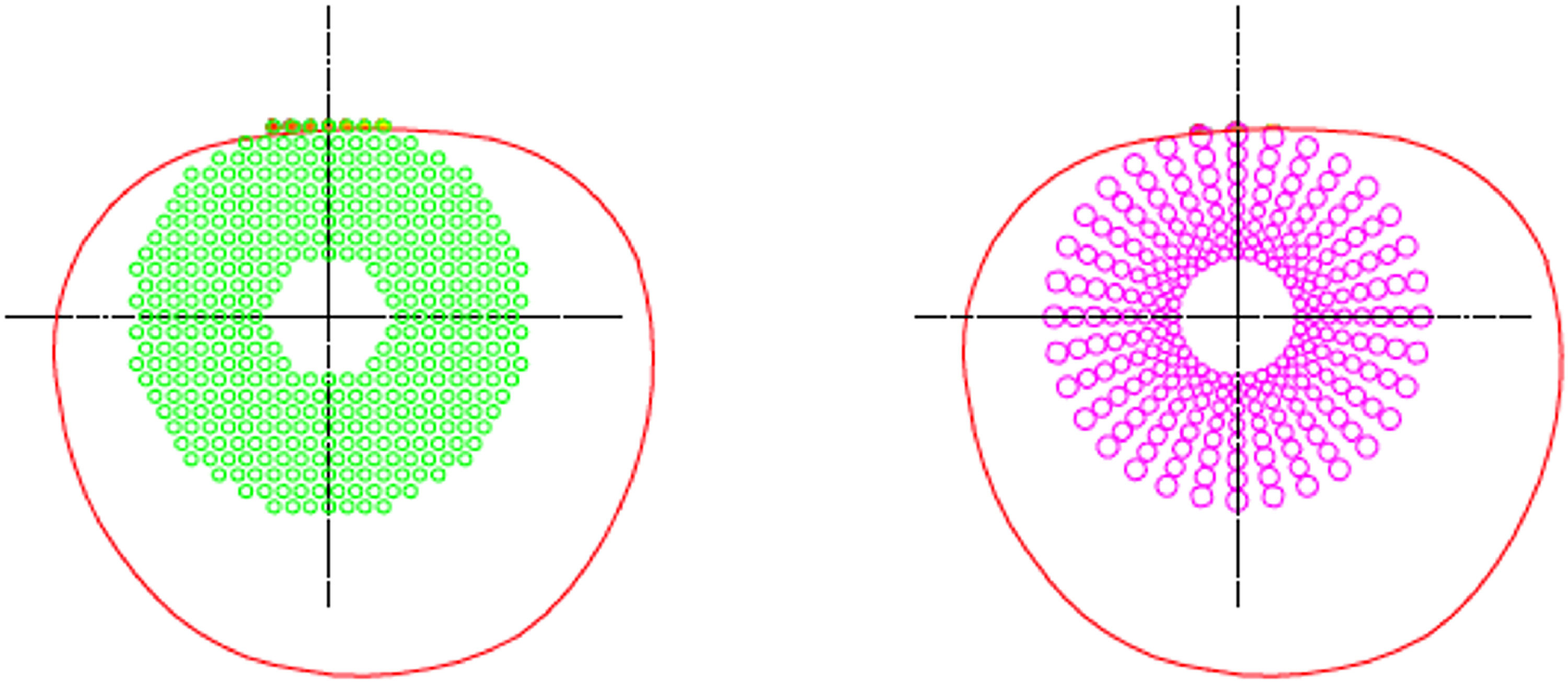 Real–world outcomes on myopia management efficacy of diverse segmented ...