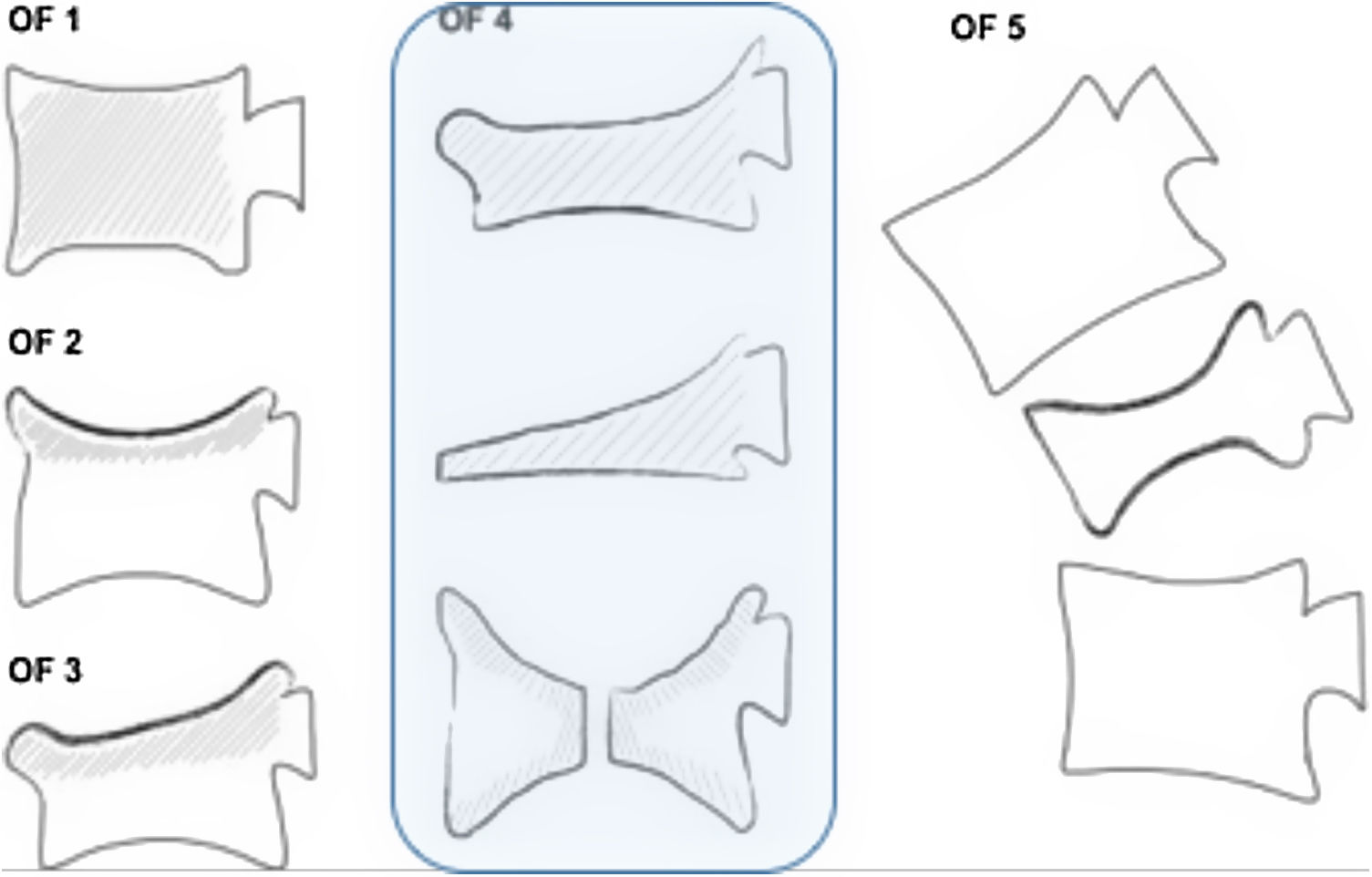 [Translated article] Minimally invasive surgical treatment options for ...